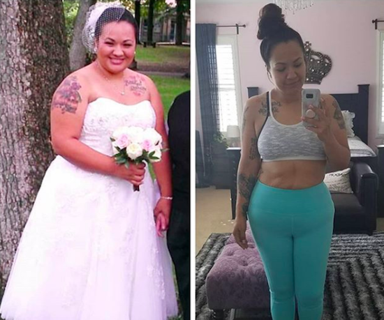 11 Before-And-After Photos That Show Eating Disorder Recovery | CafeMom.com