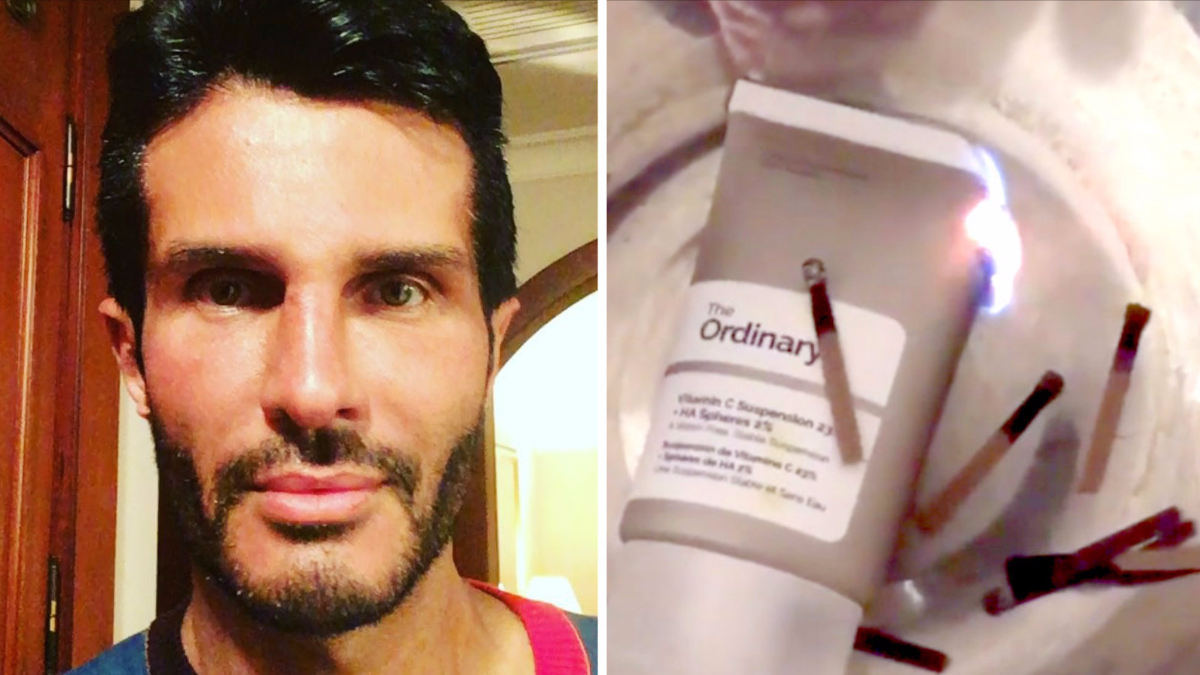 People are burning The Ordinary products | CafeMom.com