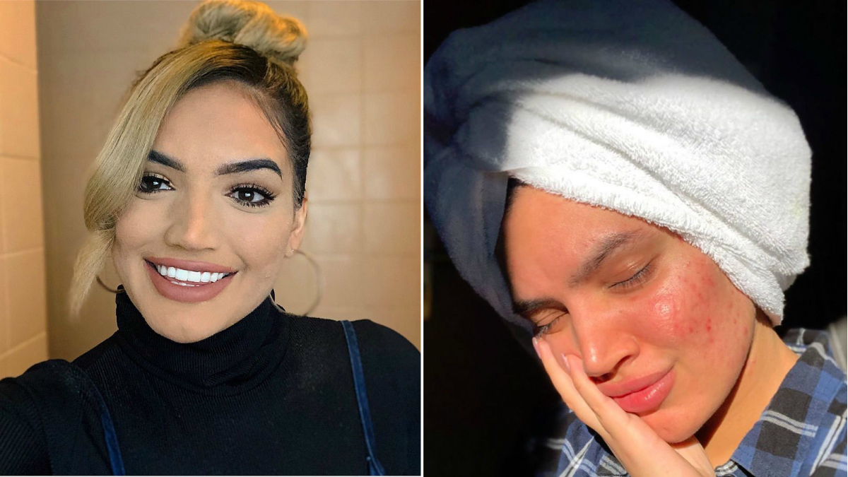 A UK-Based Influencer Revealed She Photoshopped Her Photos To A Point ...