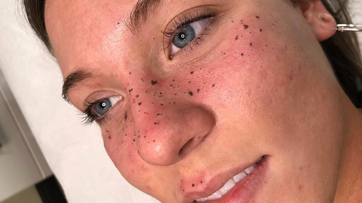 Freckle tattoos are a thing, but they're not that crazy | CafeMom.com