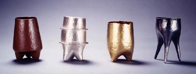 Pak Song-chol Exhibition （Metal Art Museum Hikarinotani） ｜Tokyo Art Beat