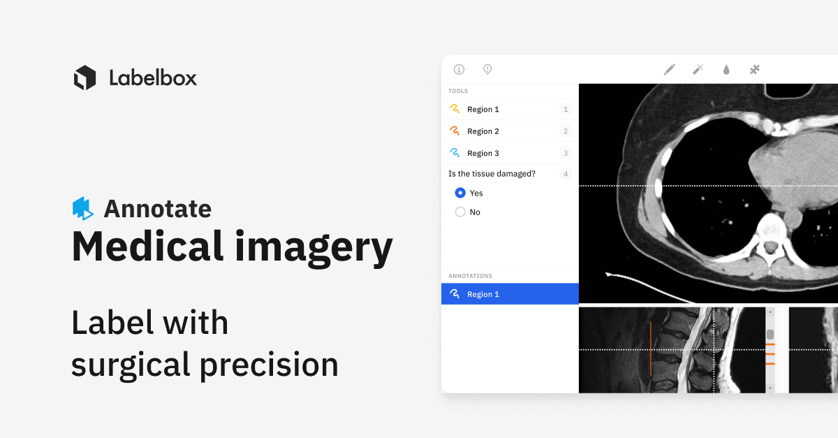 Medical Data Annotation & Labeling Tool | Labelbox