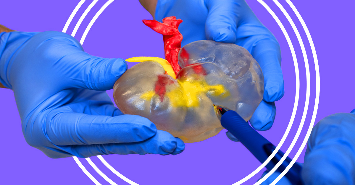 Barriers to additive manufacturing in healthcare | Ricoh USA