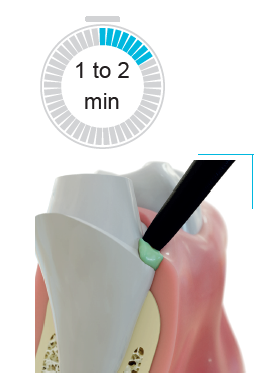 Fast, simple & affordable protocol