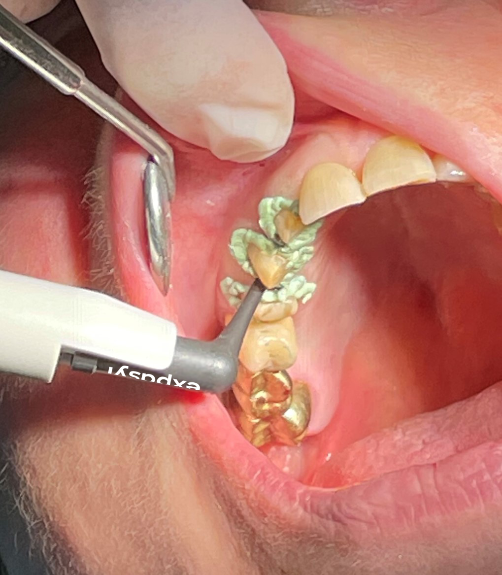 Effective & atraumatic