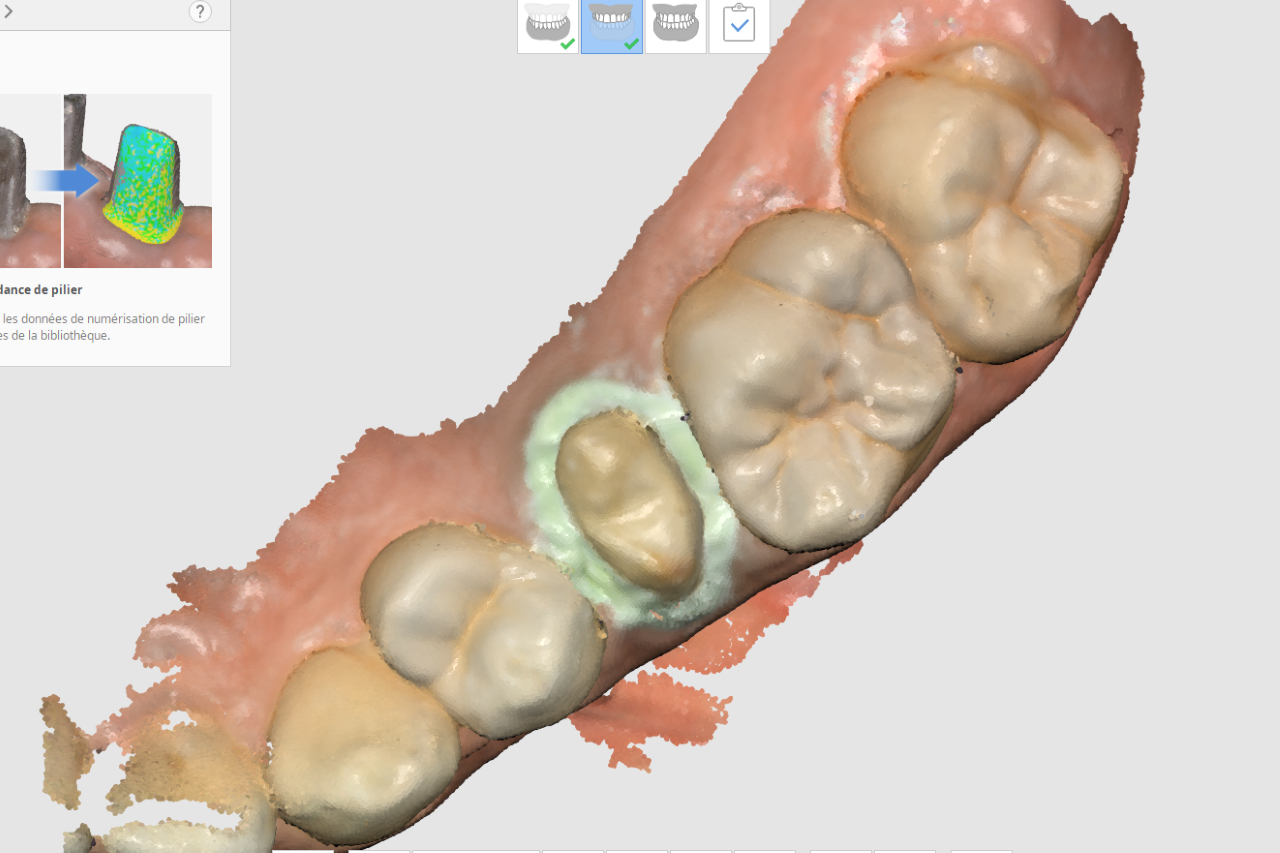 An excellent tool for CAD/CAM