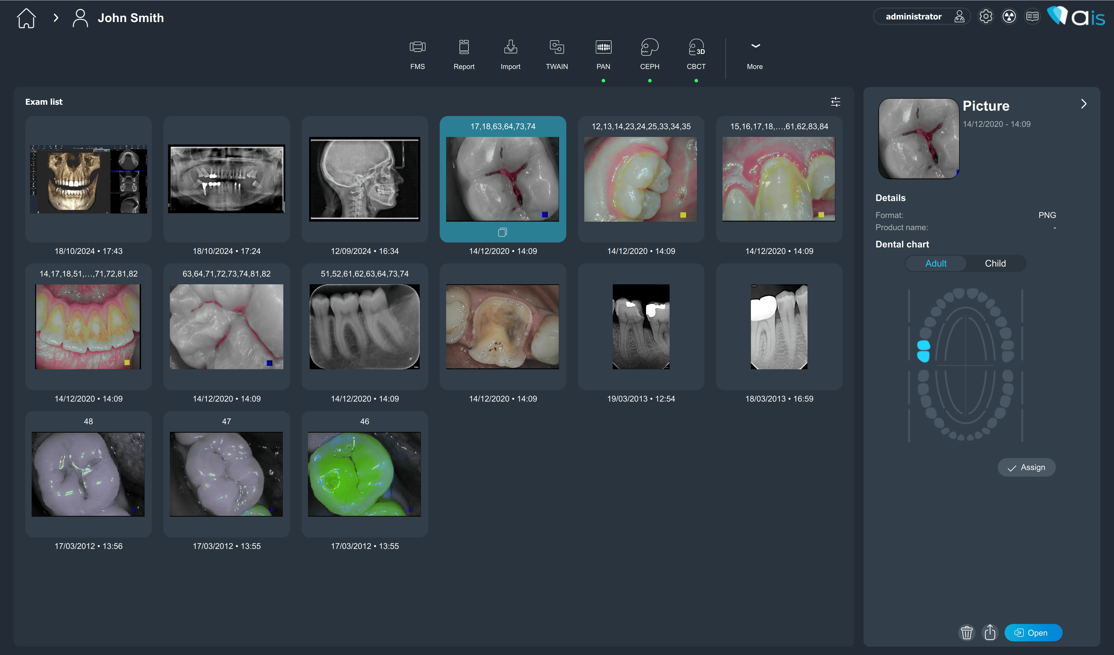 revamped in its functional architecture ais 5 . 4 becomes a true ...
