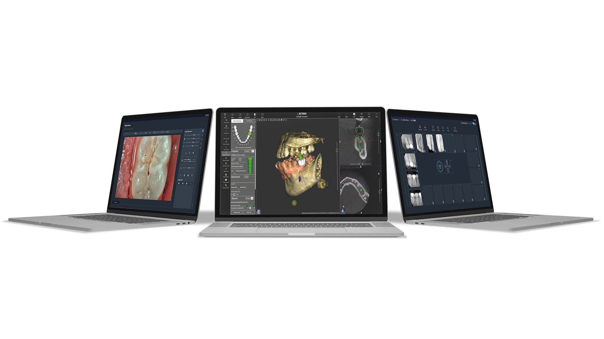 ACTEON® Imaging Suite