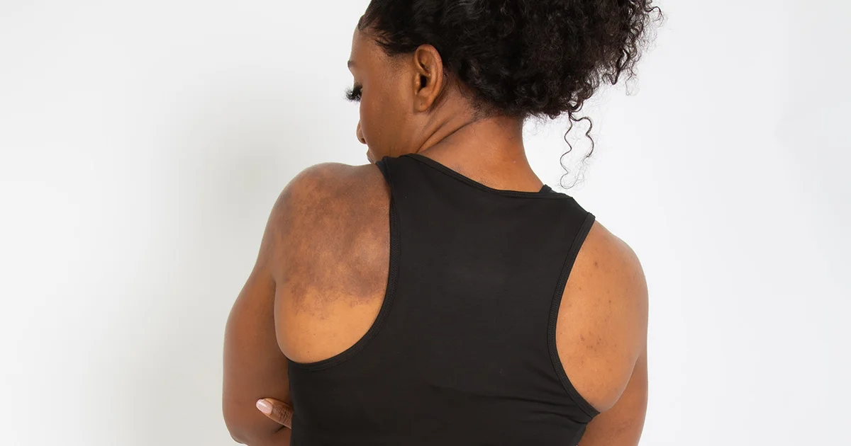 How Does Zepbound (Tirzepatide) Work for Weight Loss? | Ro