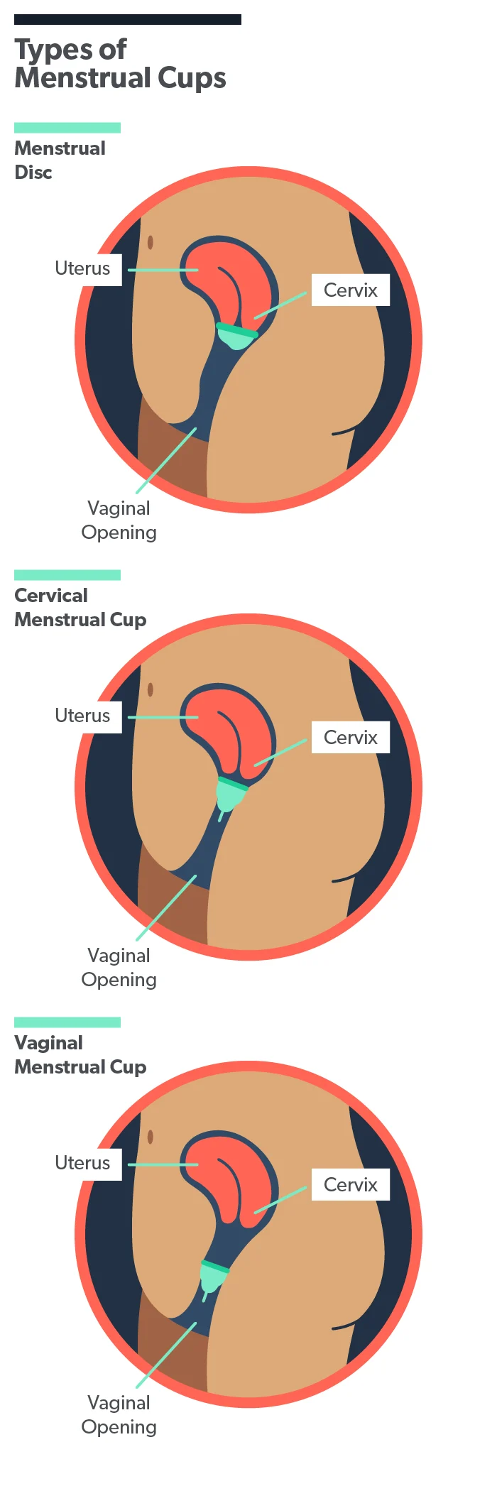 diva cup insertion tips