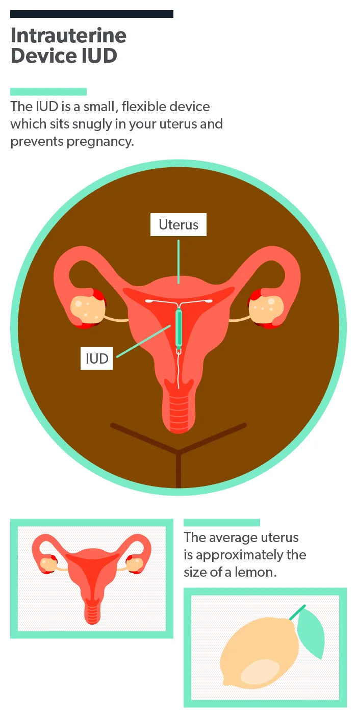 Iud Types Side Effects Effectiveness Risks Ro