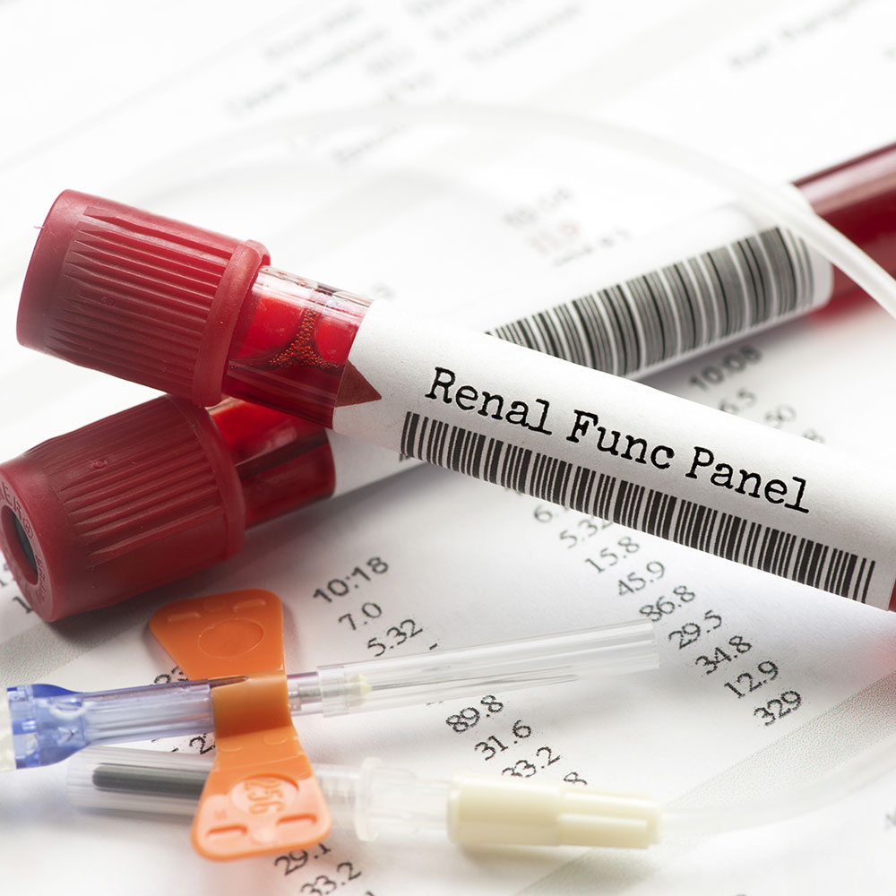 What Are Normal Creatinine Levels? | Ro