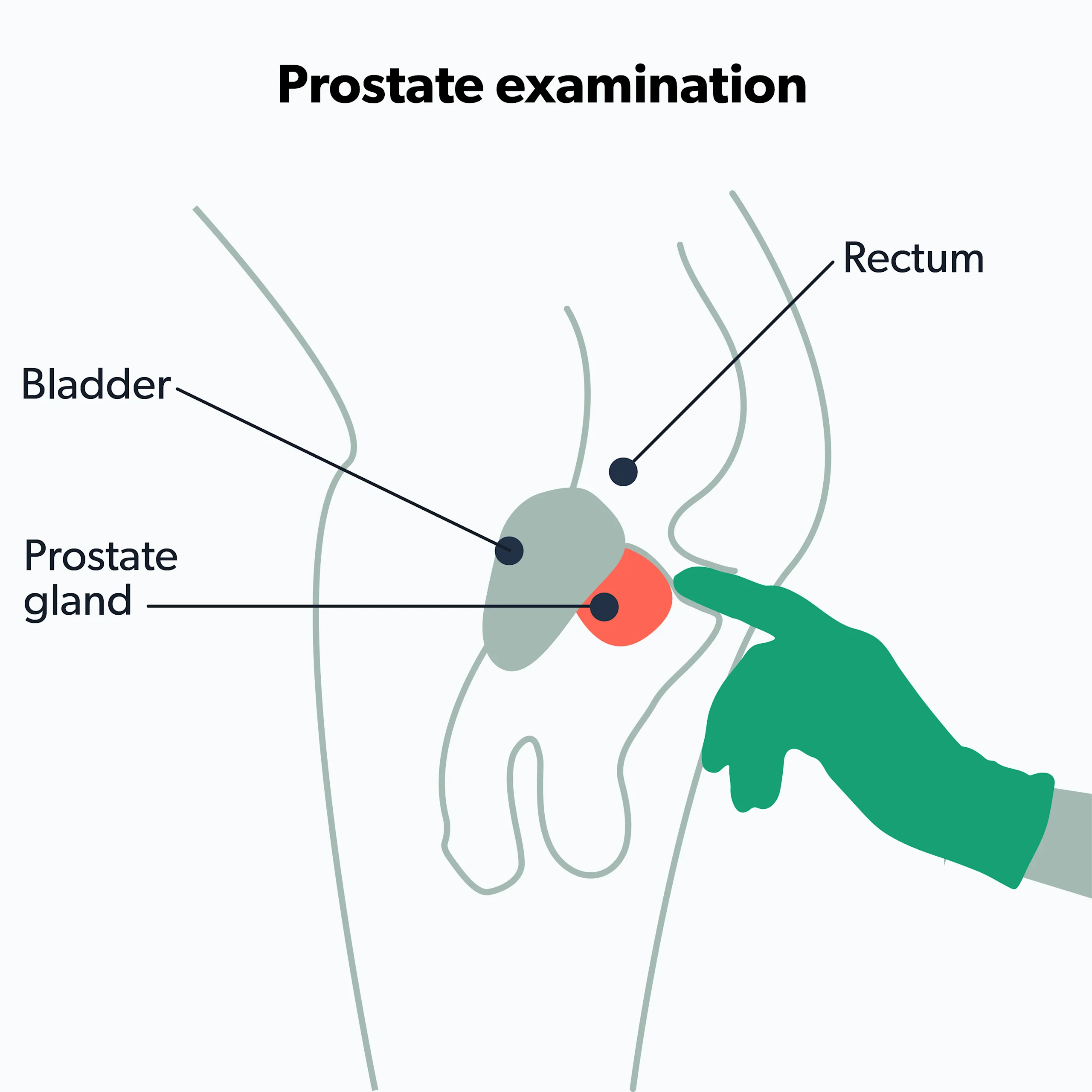prostate exam schedule