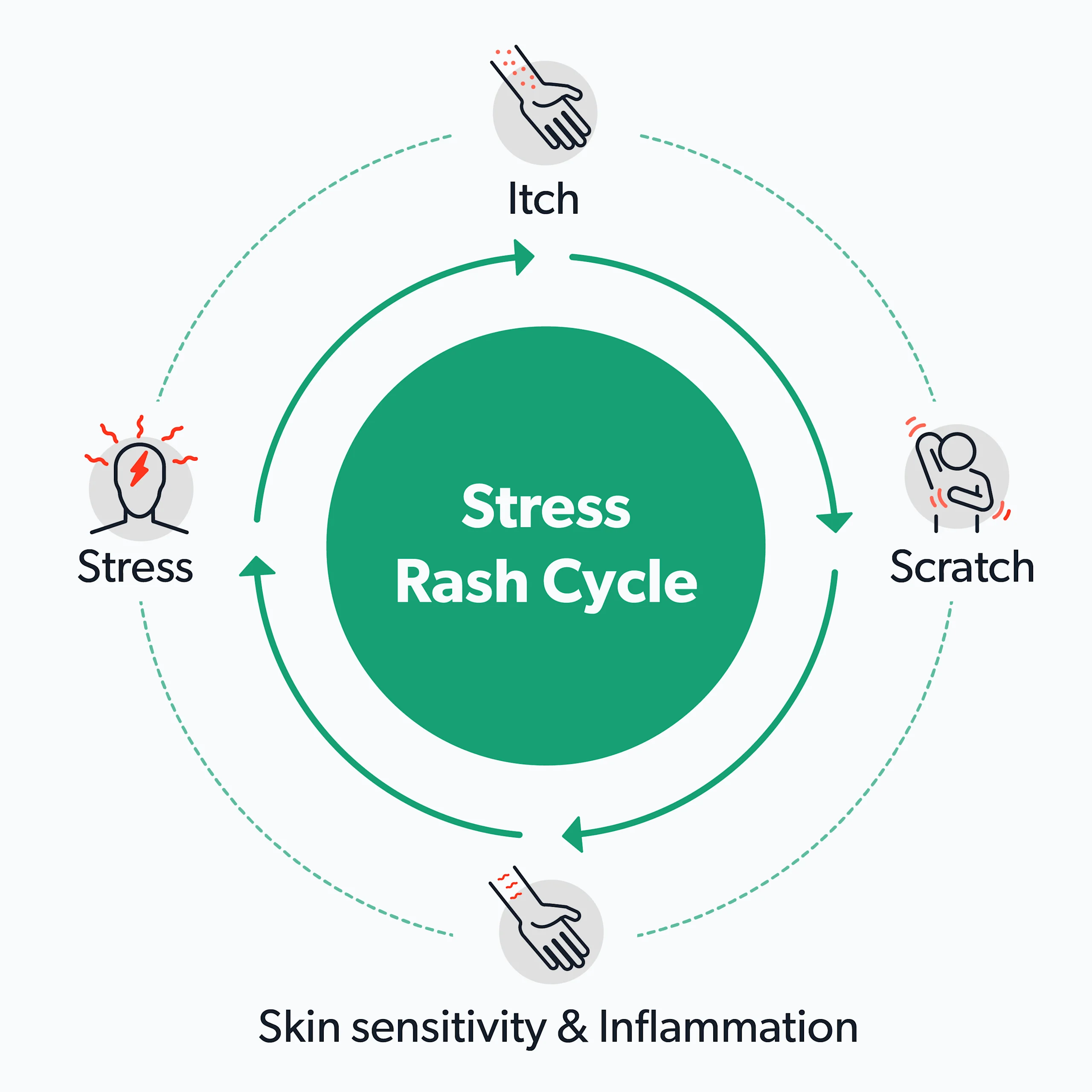 Stress Rash: Causes and Treatments | Ro