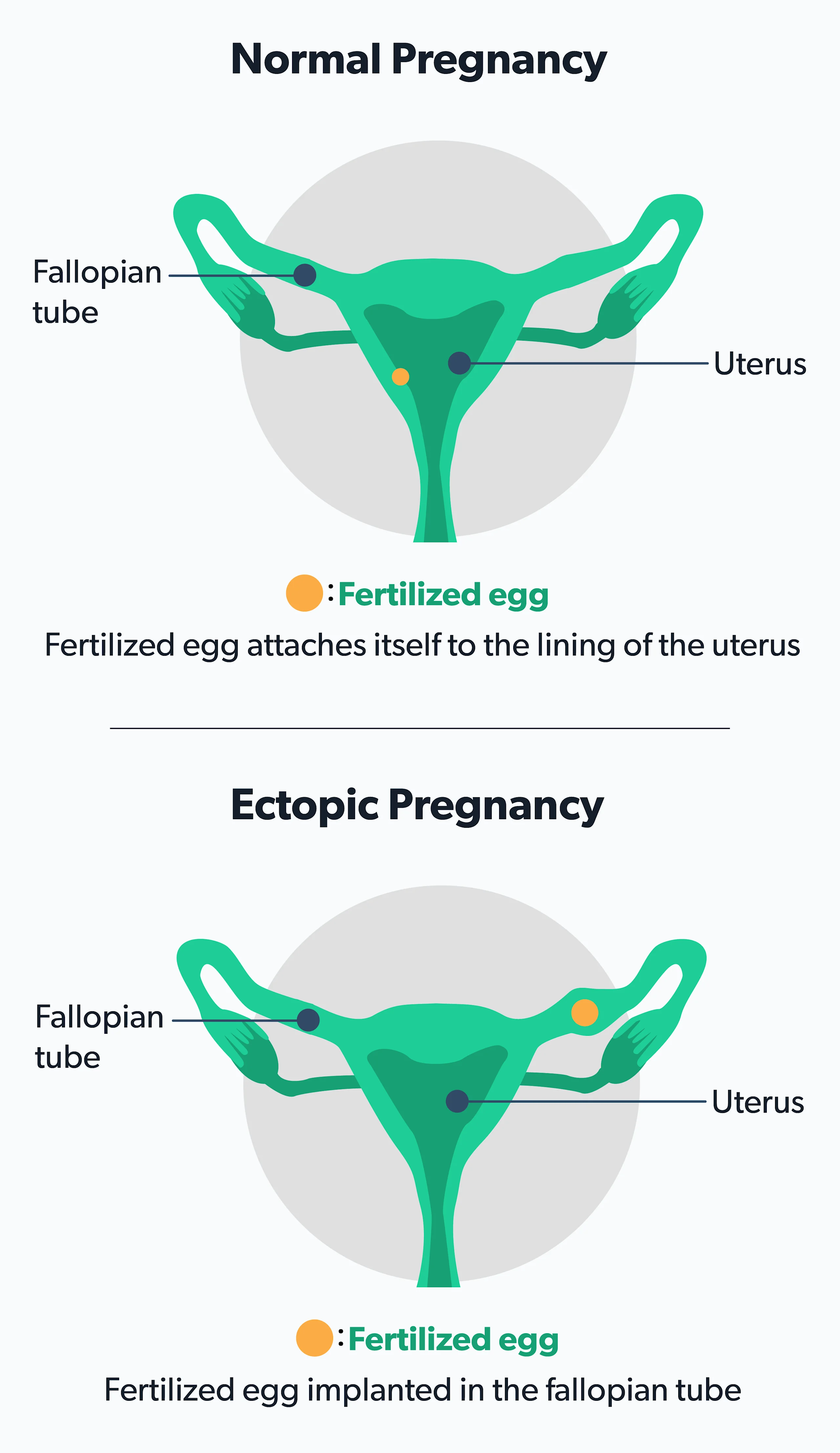 chlamydia cervix bleeding