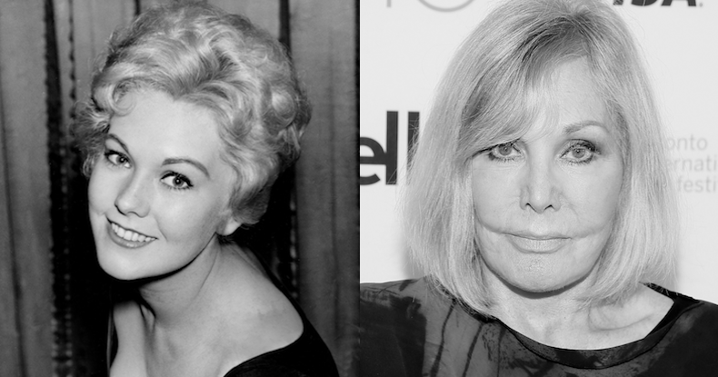 Kim Novak Before And After