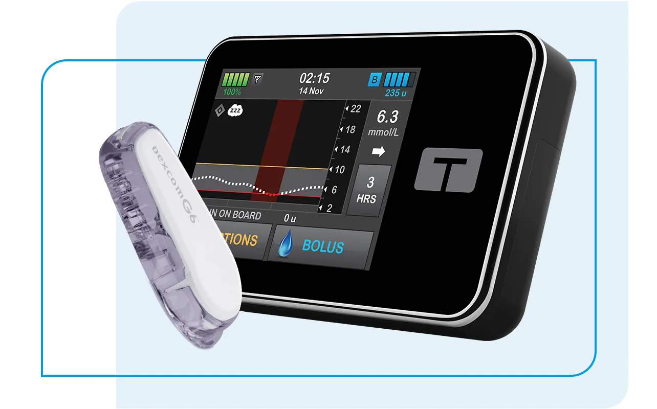 Order an Insulin Pump Today | Tandem Diabetes Care