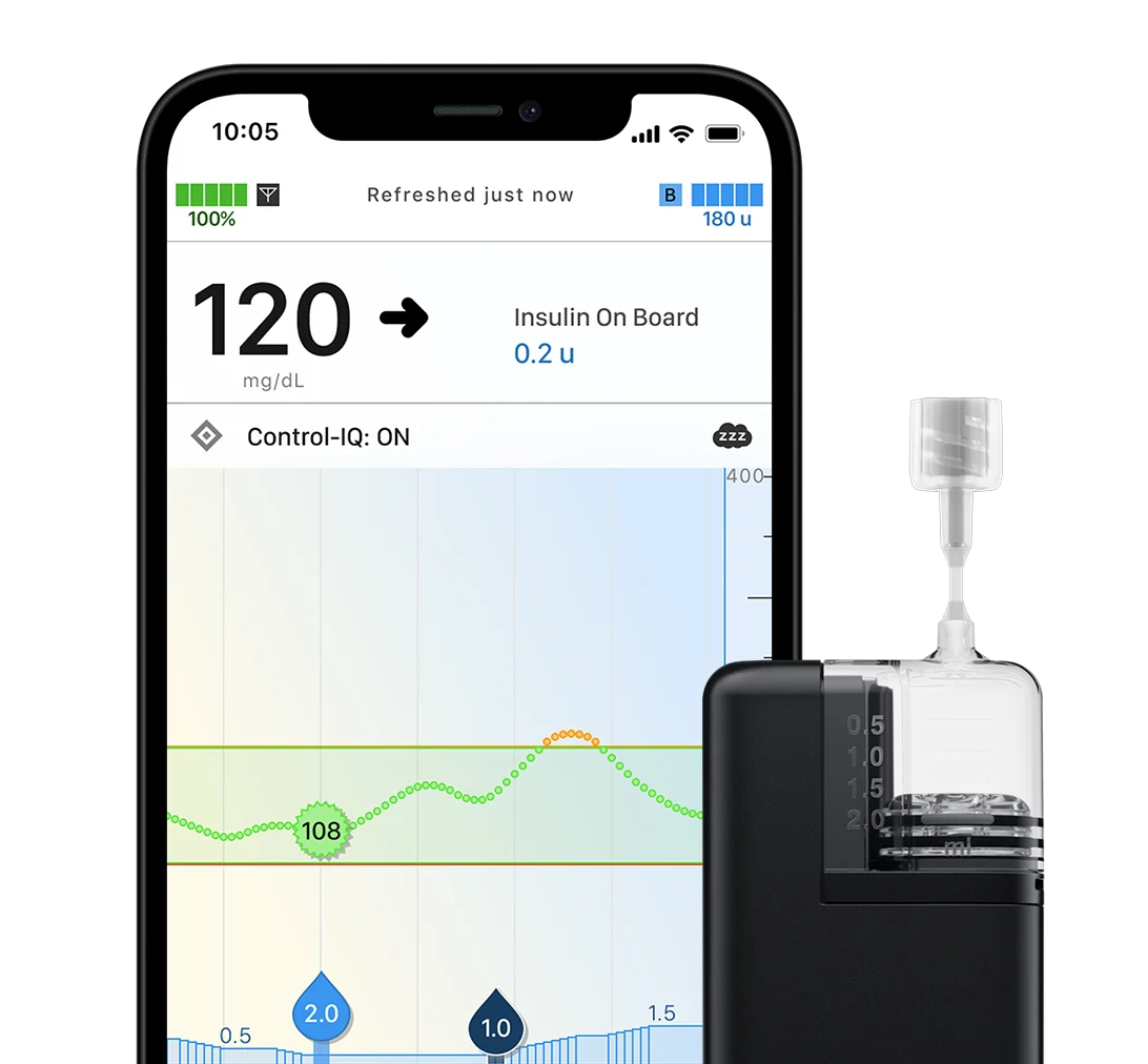 Insulin Pumps and AID systems | Tandem Diabetes Care