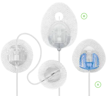 Insulin Pump Infusion Sets | Tandem Diabetes Care