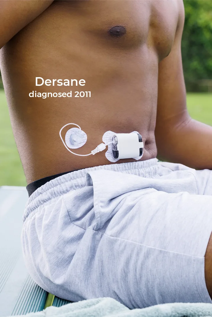 Tandem Mobi System | Tandem Diabetes Care