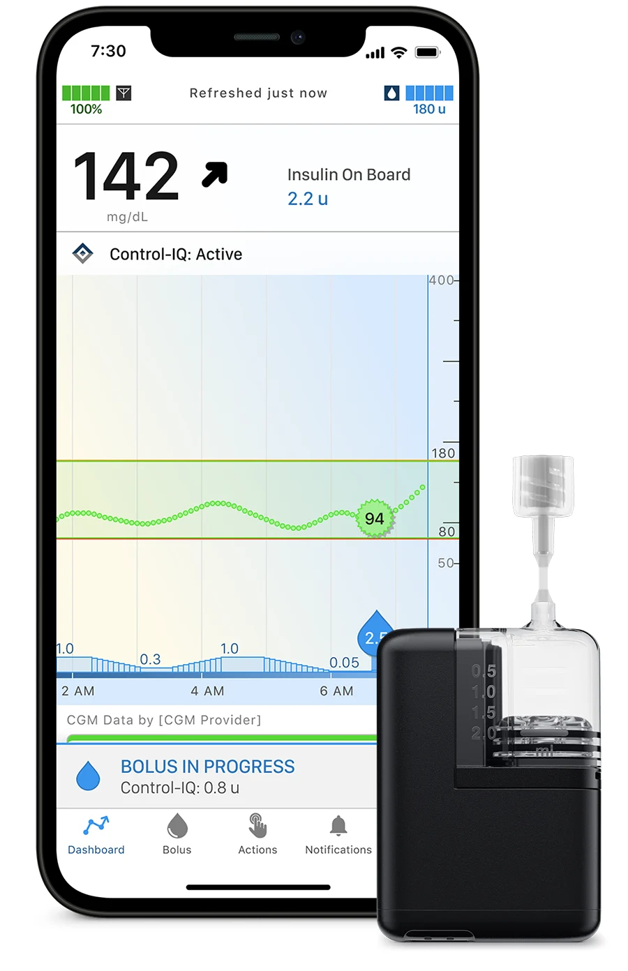 Tandem Mobi Automated Insulin Delivery System | Tandem Diabetes Care