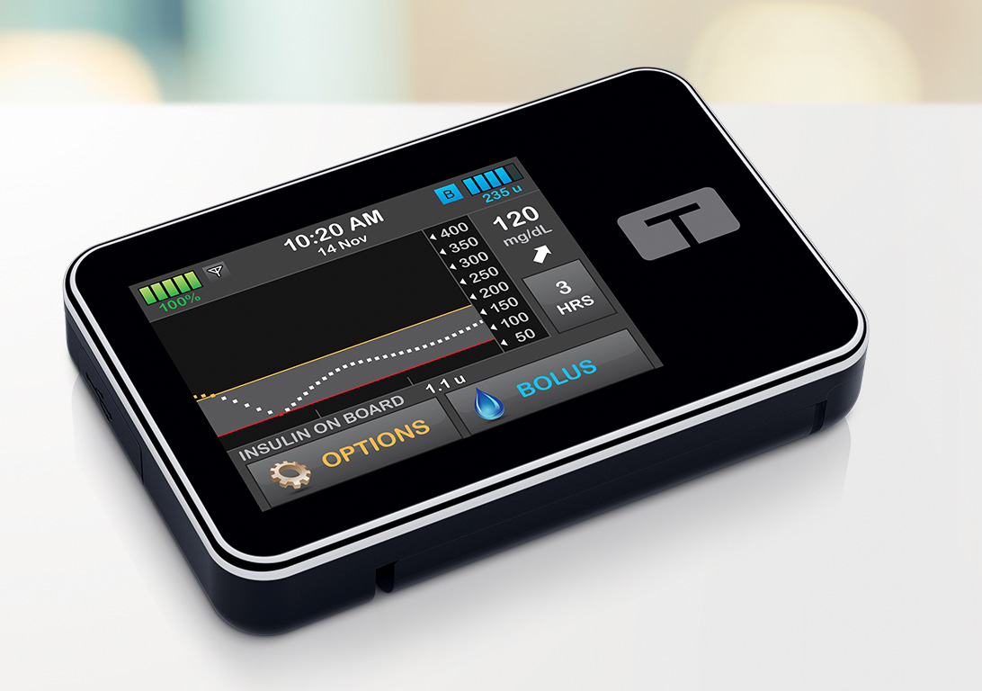 Hybrid Closed-Loop Insulin Pump Systems for Diabetes | Tandem Diabetes Care
