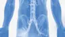 Terumo Neuro | Innovative Neurovascular Solutions | Terumo Neuro