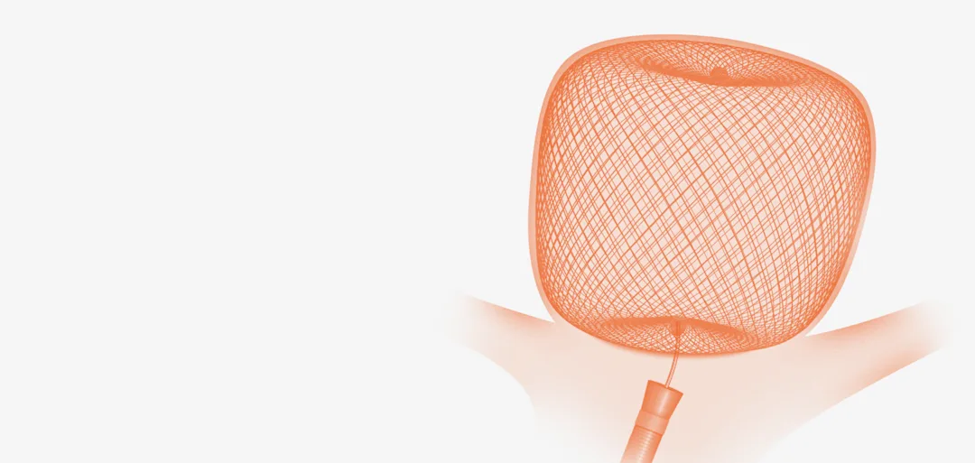 Therapeutic | Terumo Neuro