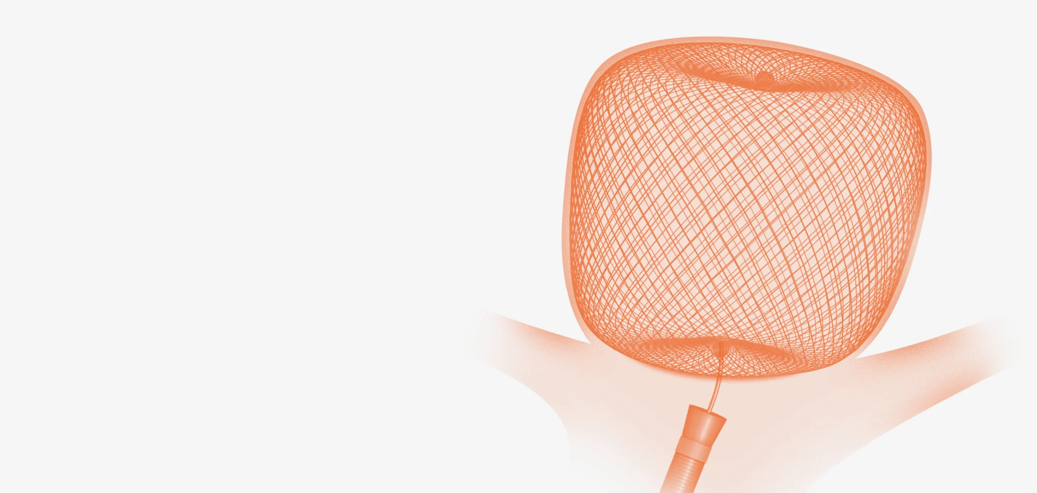 Therapeutic | Terumo Neuro