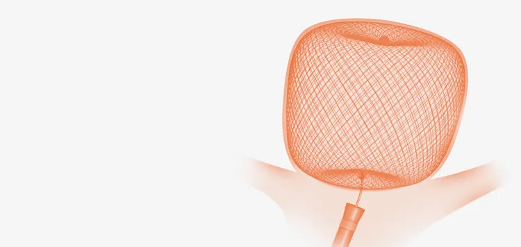 Therapeutic | Terumo Neuro