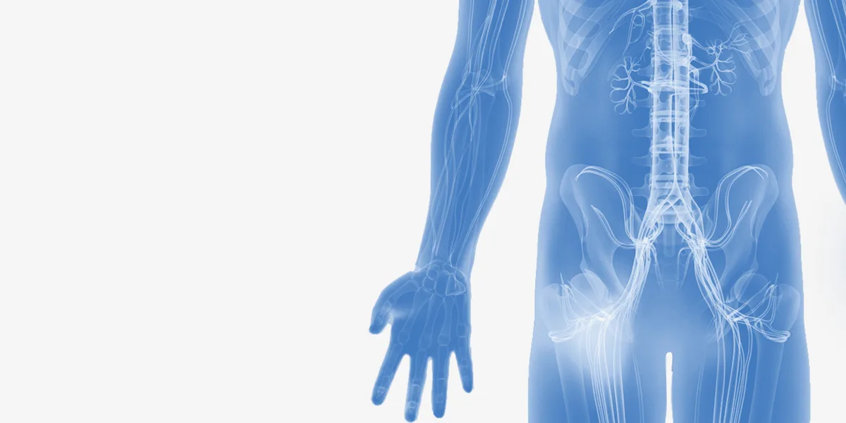 Access | Terumo Neuro