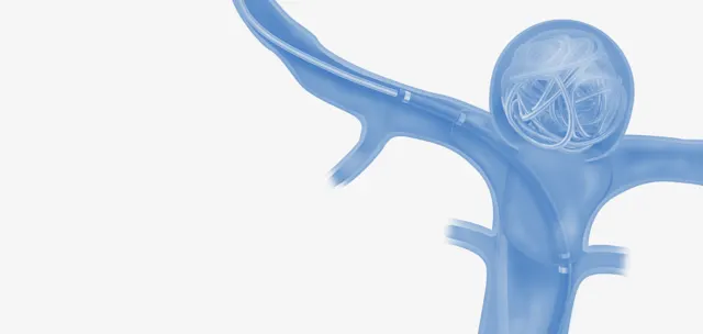 Access | Terumo Neuro