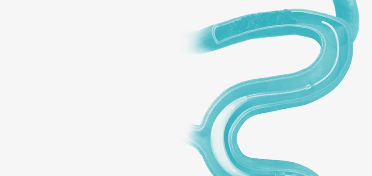 Ischemic | Terumo Neuro