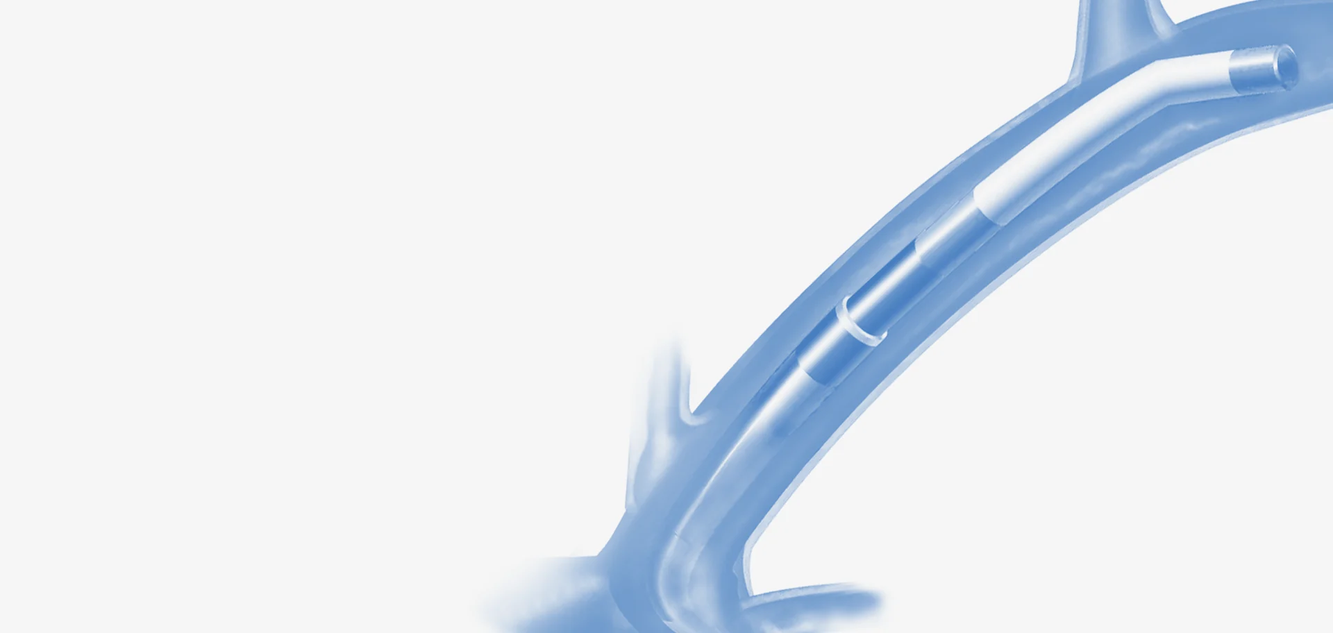 Access | Terumo Neuro