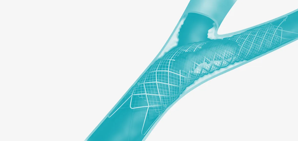 Ischemic | Terumo Neuro