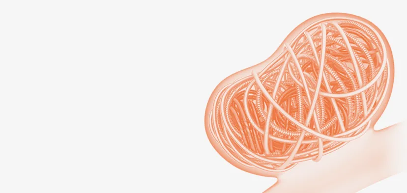 Therapeutic | Terumo Neuro