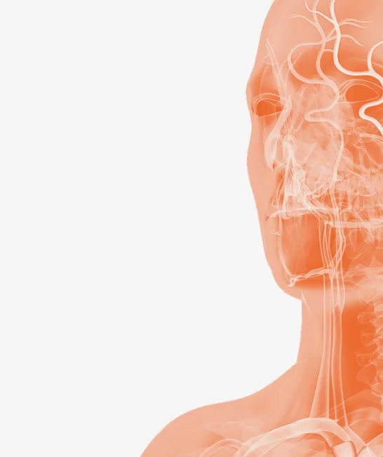 Products | Terumo Neuro