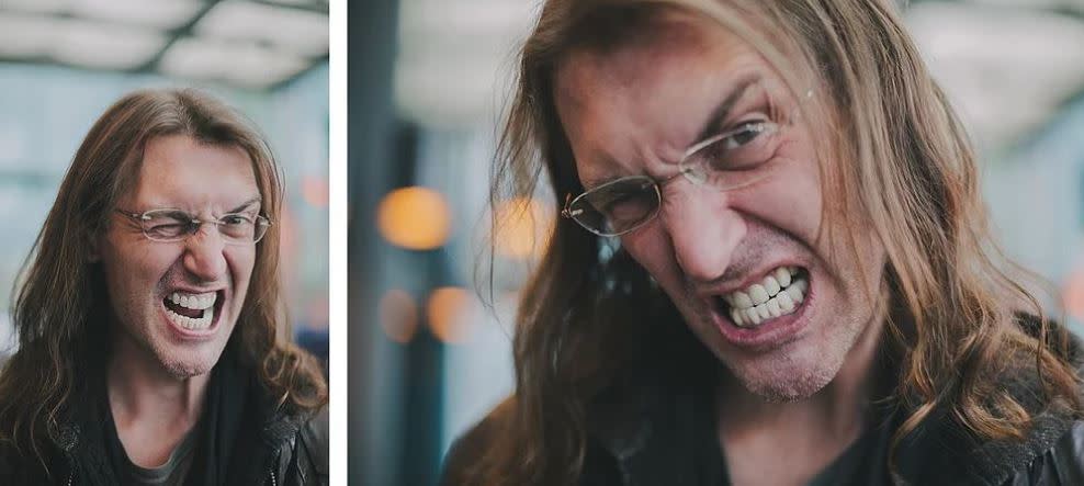 Patient Goes To Croatia For Affordable Dental Treatment | Qunomedical