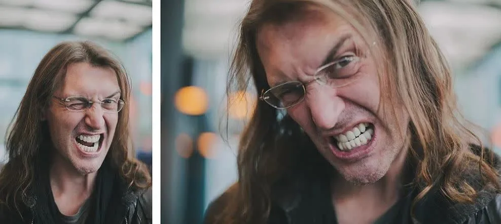 Patient Goes To Croatia For Affordable Dental Treatment | Qunomedical