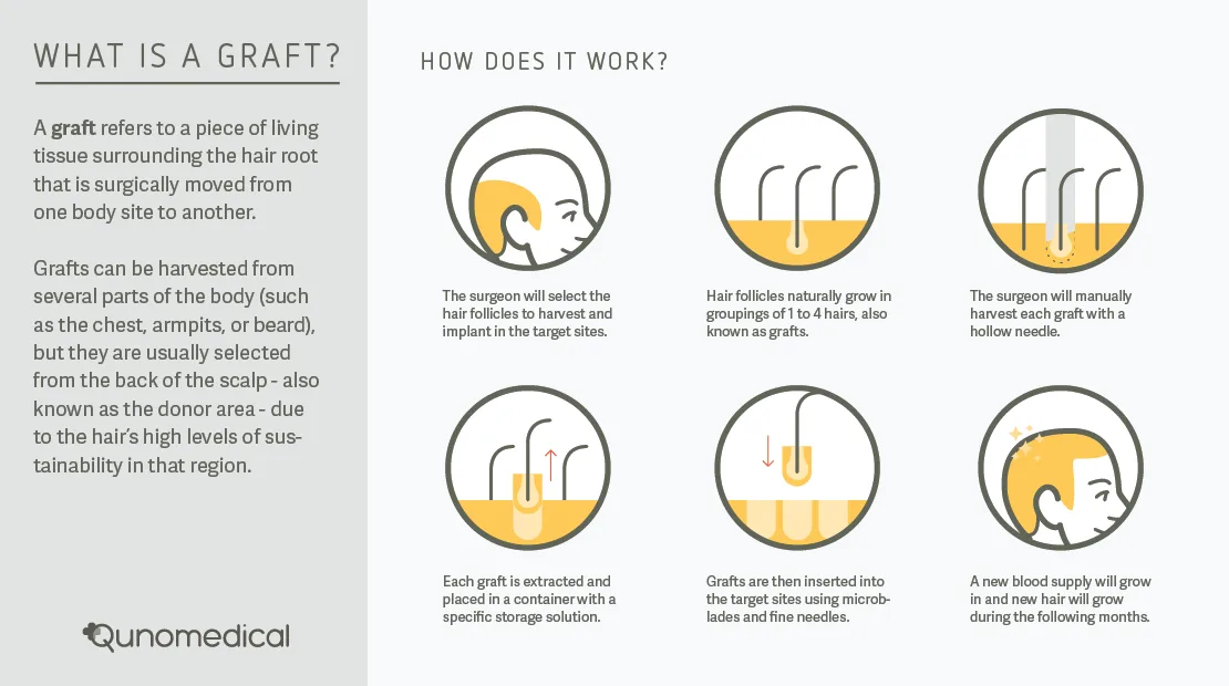 Guides - Medical Guides, Infographics, and more | Qunomedical