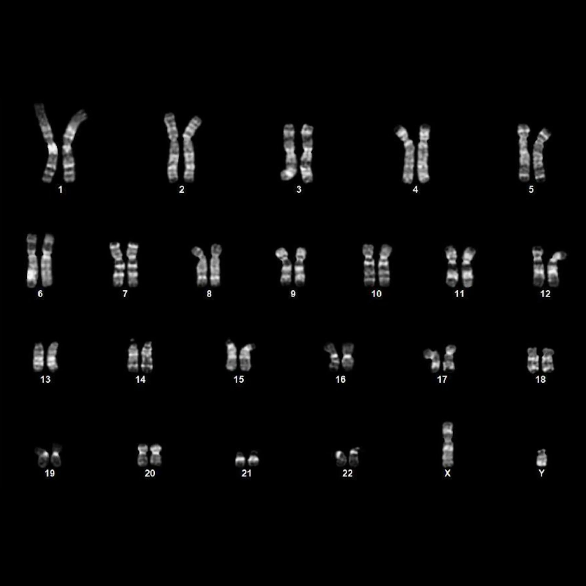 Accelerating life sciences research | OpenAI