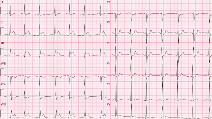 Helpful App — Heart Attack Diagnosis and Treatment