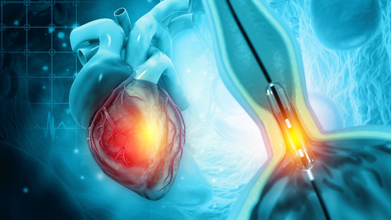 Helpful App — Pre-Op Prep for Coronary Artery Bypass Graft (CABG)