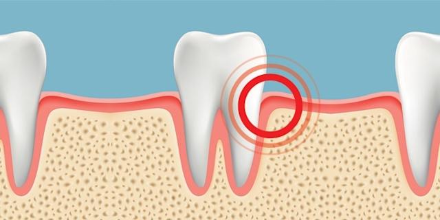 Inflamed Gums: Causes and Treatments for Gum Swelling | Crest