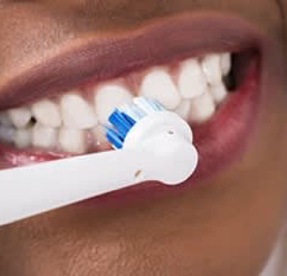 What is Plaque: Causes, Treatment And Prevention | Crest CA