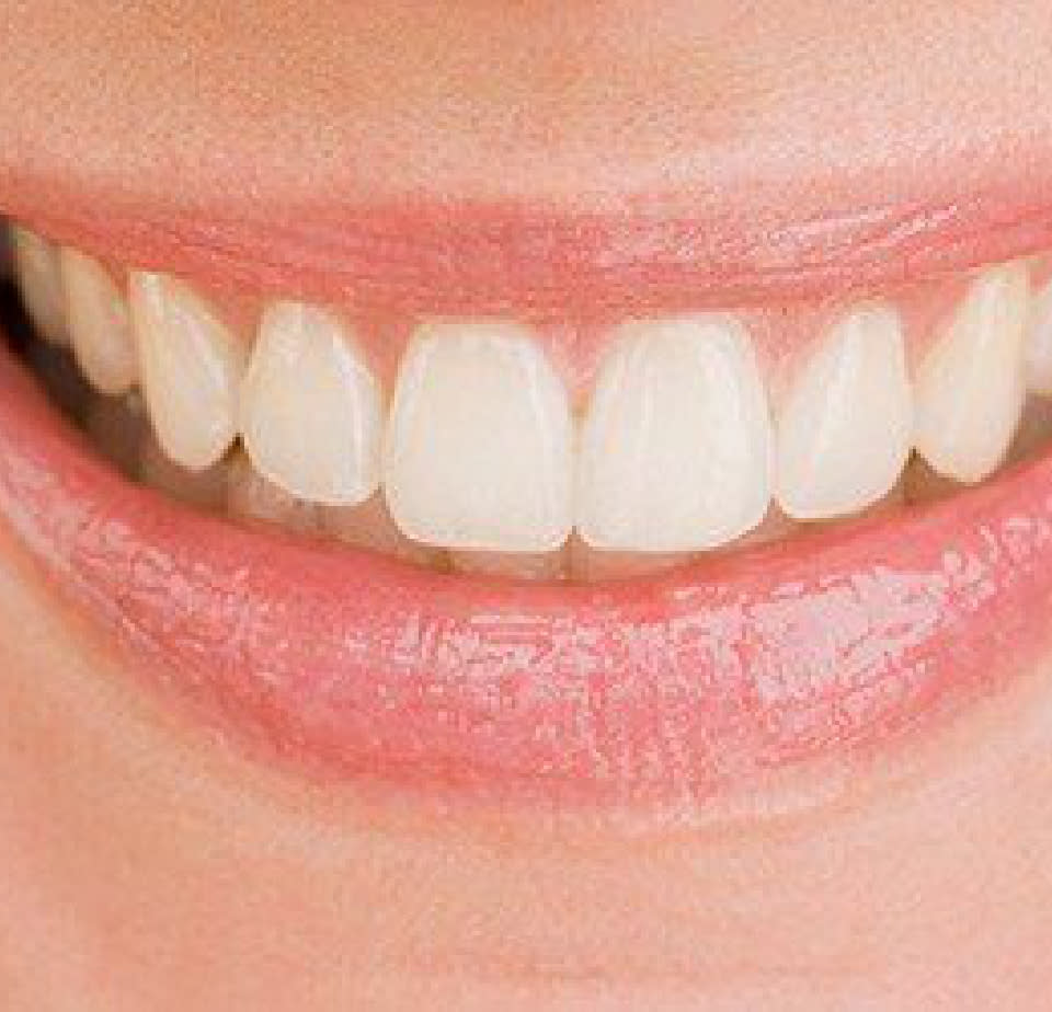 Gum Disease Pictures: What do Healthy Gums Look Like | Crest CA