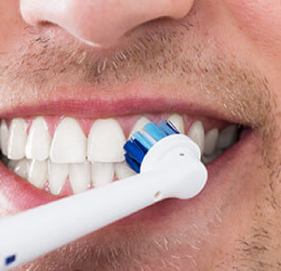 What is Tartar: Causes and Prevention | Crest CA