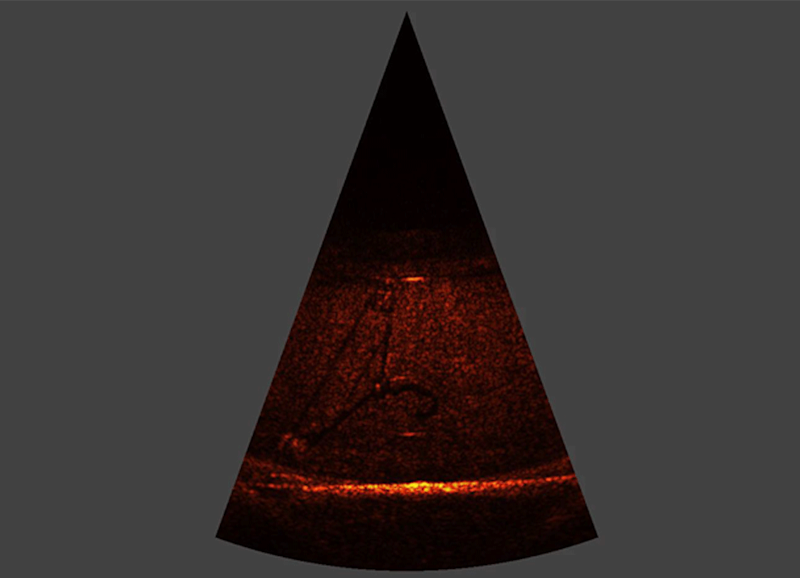 Sonar Blueprint Oculus M3000D | Deep Trekker