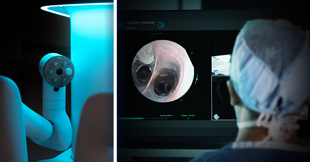 First MONARCH® Robotic-Assisted Bronchoscopy Procedure Performed ...