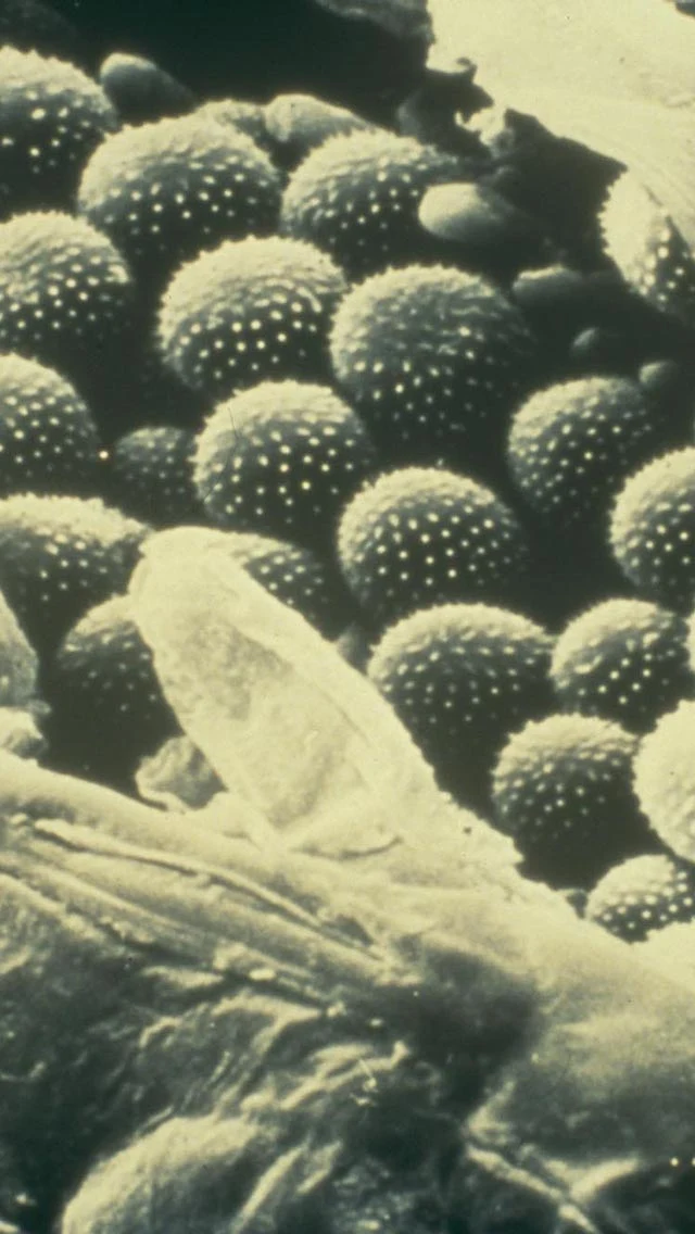 Yellow Rust | Cereal Crop Disease